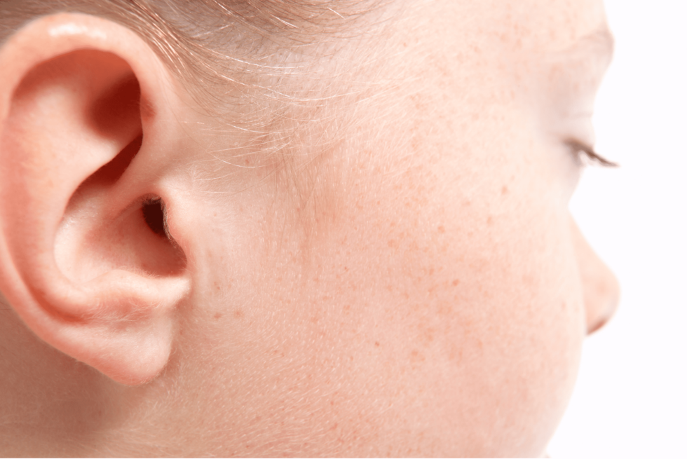 Otoplastia Canarias | Clínica ICA